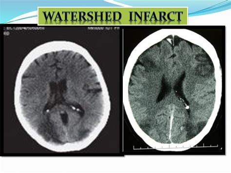 Dr Monica Patil Jr Iii Dept Of Radiology Guide Dr Sagar Kadam Ppt Download