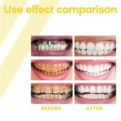 Propolis Gum Care Gel Propolis Oral Gum Repair Gel Propolis Teeth