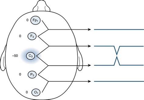 Abret Reegt Study Guide Localization And Polarity Flashcards Quizlet