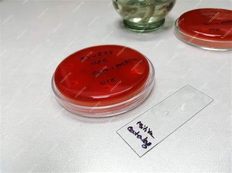 Premium Photo Catalase Test In Microbiology Where Staphylococci Are Positive And Streptococci