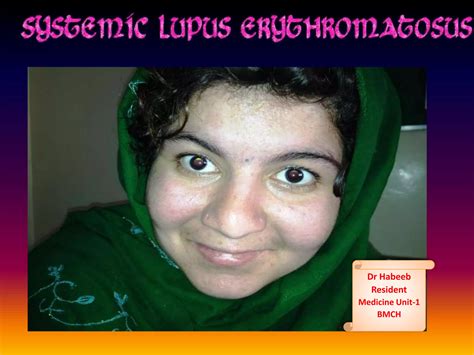 Systemic Lupus Erythromatosus Pptx