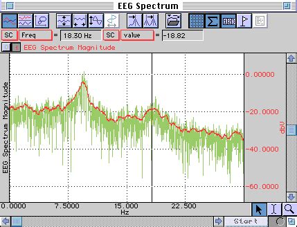 EEG Electroencephalography Spectral Analysis Research BIOPAC