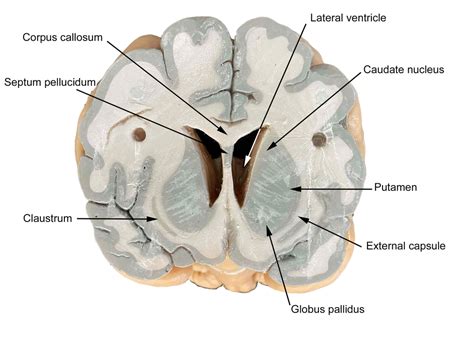 Brain Coronal Sections Human Anatomy Web Site