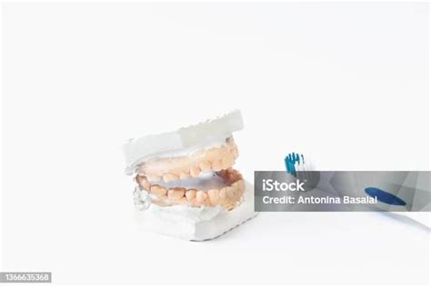 전문 치과 진료소 흰색 배경에 치과 석고 모델 고립 턱의 석고 모델 치과 치열 교정 칫솔 클로즈업 건강관리와 의술에 대한 스톡 사진 및 기타 이미지 Istock