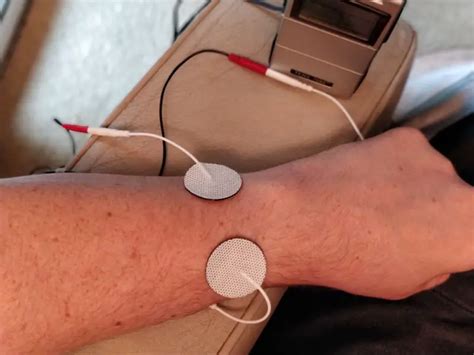 Tens Unit Placement For Wrist Pain Optimize Health 365