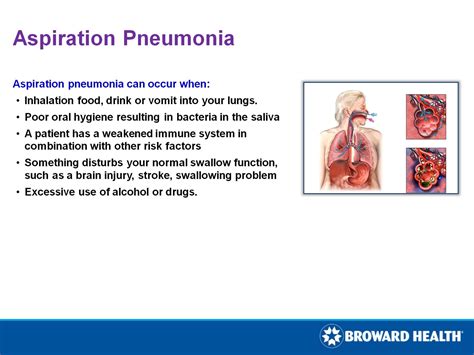Pneumonia Vs Aspiration Pneumonia