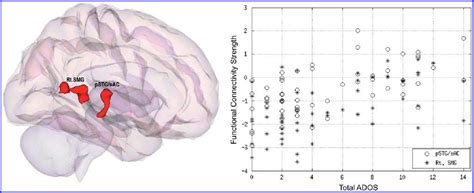 Table 1 From Integration And Segregation Of Default Mode Network
