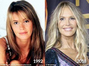 The Subtle Beauty Of Elle Macpherson Dr Haworth