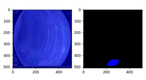 effect of reduce zero label · issue 1714 · open mmlab mmsegmentation
