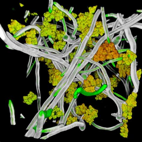 Oral Sites Of Polymicrobial Candida Biofilm Diseases The Schematic