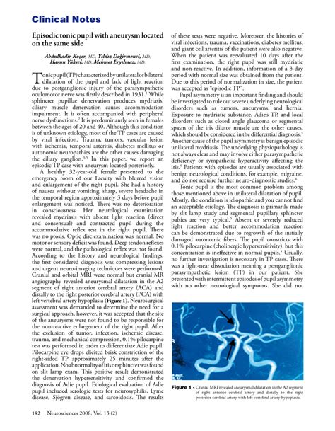Pdf Episodic Tonic Pupil With Aneurysm Located On The Same Side