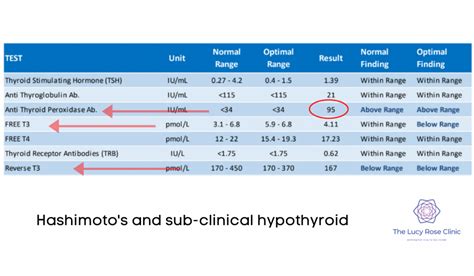 Treating Hashimotos Holistically Hashimotos Disease Treatment The