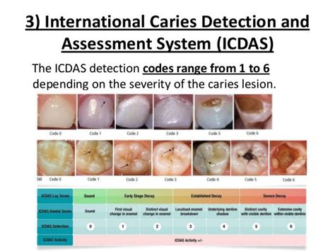Classification Of Dental Caries Rasha Adel Copy
