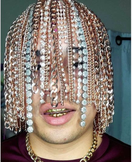 Rapper Dan Sur Gets Gold Chains Surgically Implanted Into His Head Photos