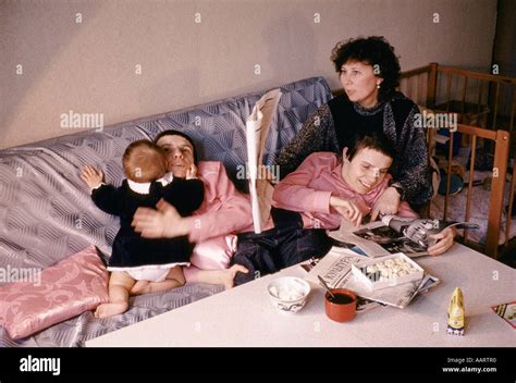 Russian Conjoined Twins Masha And Dasha Krivoshlyapova In Moscow Stock