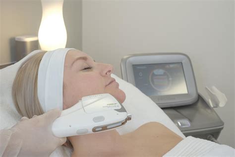 Chin Filler A Comprehensive Guide