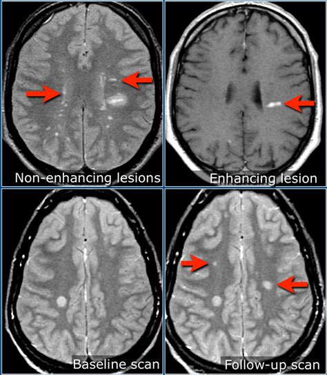 Non Specific Brain Lesions Health Checklist