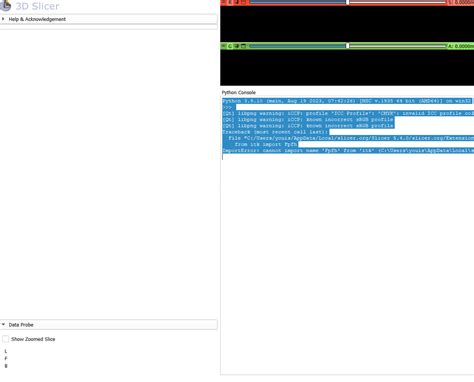 I Cannot Use Alpaca Module Support 3d Slicer Community