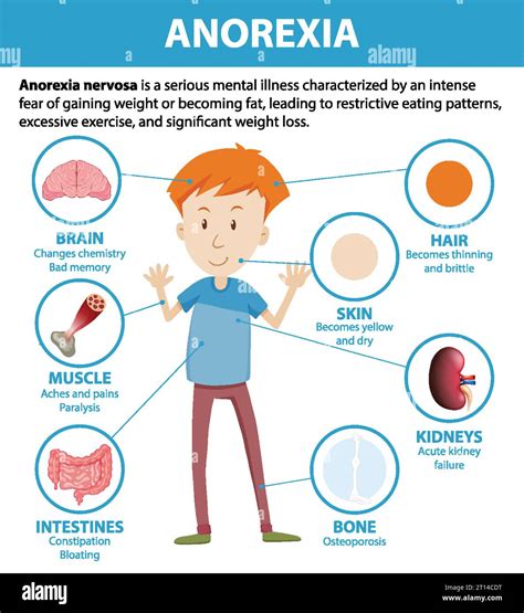 Effects Of Anorexia On Male Cartoon Anatom Stock Vector Image And Art Alamy