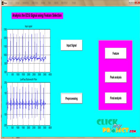 Electrocardiogram Signal Modeling With Adaptive Parameter Estimation Using Sequential Bayesian