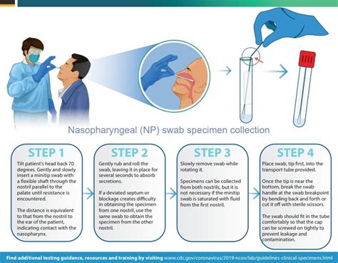 Nasopharyngeal Swab For Pertussis Testing Collection Laboraotry