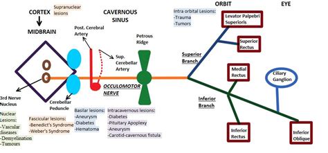 Cranial Nerve Iii Palsy Md Searchlight