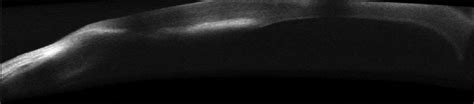 The Pan American Journal Of Ophthalmology