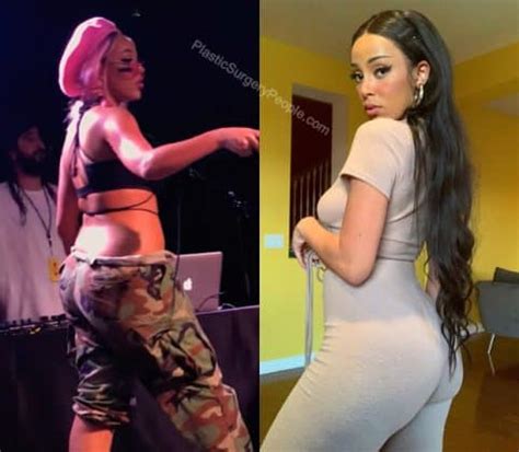 Doja Cat Before And After 2022