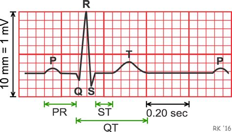 Download Hd Electrocardiogram Durations And Intervals