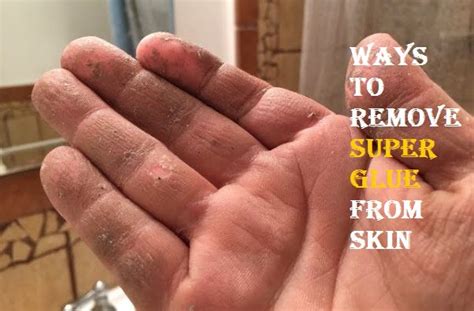 How To Remove Super Glue From Skin