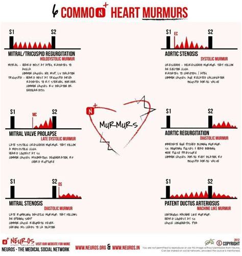 Heart Murmurs