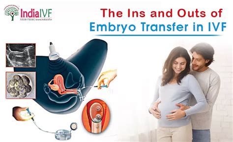 Embryo Transfer In Ivf A Guide By India Ivf Fertility