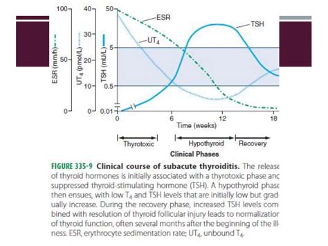 Hyperthyroidism Ppt Pptx