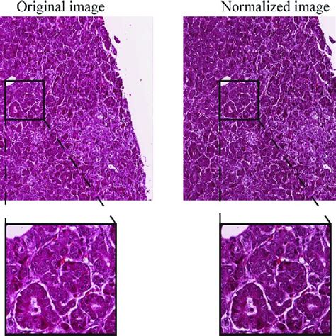 Pdf Stain Normalization In Digital Pathology Clinical Multi Center Evaluation Of Image Quality