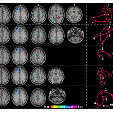 Sources Of Relative Gamma Synchronization At The Beginning Of The Download Scientific Diagram