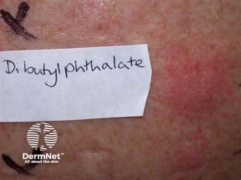 Patch Test Images