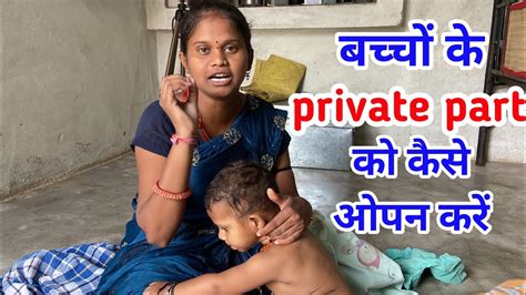 How To Open Beby Private Part Beby Ka Private Part Open Kaise Kare