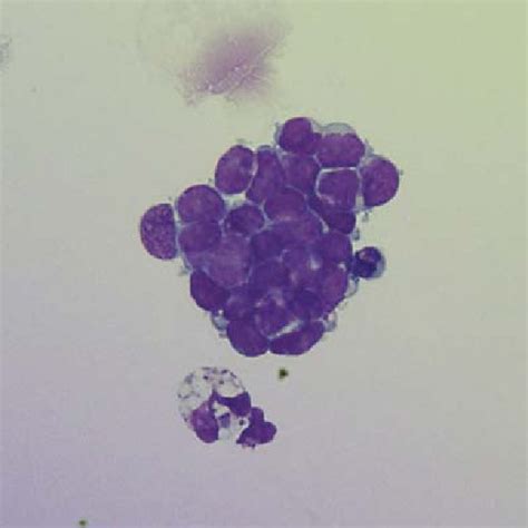 Right The Similarity In Location Between The Phlycten Superficial