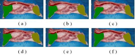 Figure 6 From A Visual Semantic Interactive Carcass Spine Interface Segmentation Method