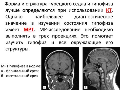 Лучевая диагностика заболеваний эндокринной системы презентация онлайн
