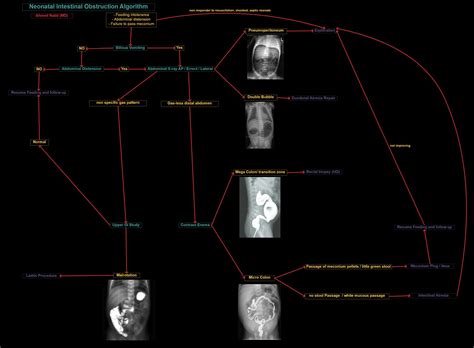 Ahmed Nabil 📷 Chart Neonatal Io Algorithm