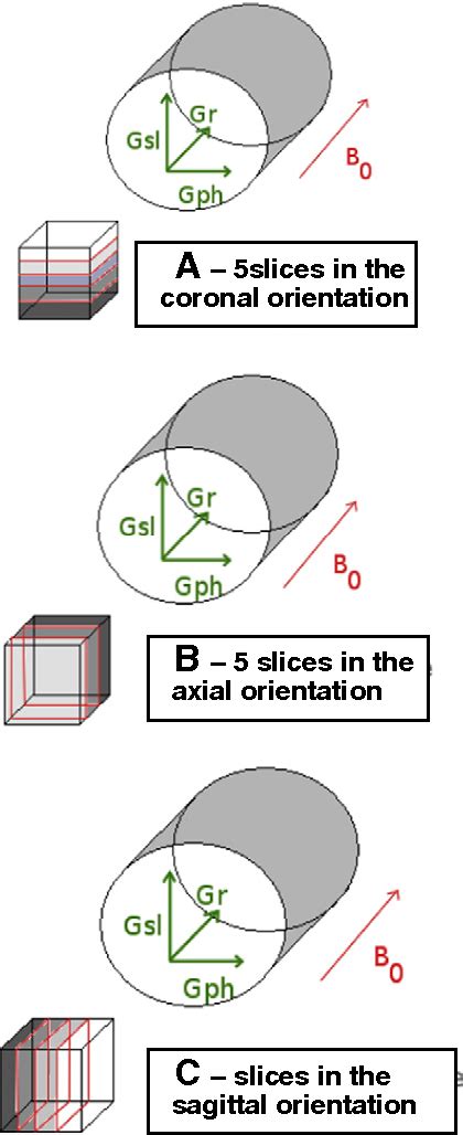 Table 2 From Improving The Accuracy Of Pgse Dti Experiments Using The Spatial Distribution Of B