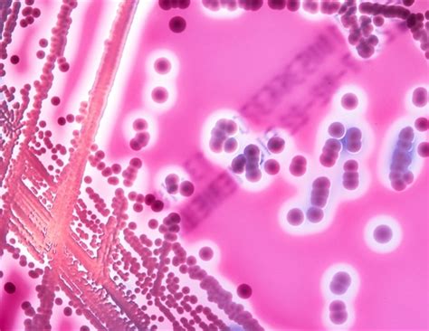 New Strain Of Streptococcus A Rampant In England And Wales