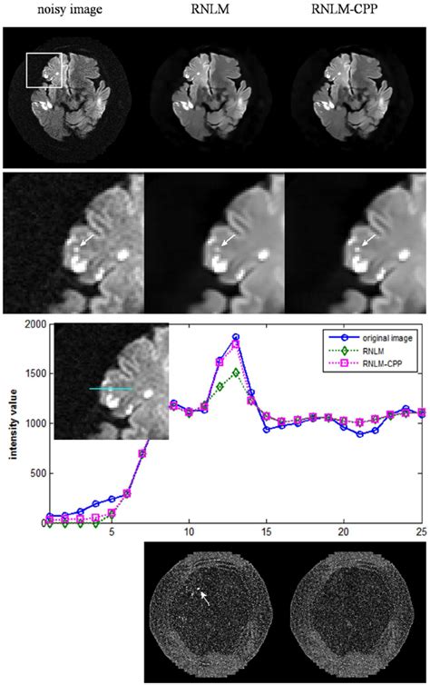 Comparison Of Rnlm And Rnlm Cpp Algorithms On Denoising Real