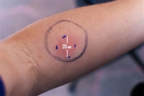 Thats Quite A Tb Test You Have There Karenmagid