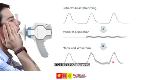 Revolutionizing Asthma And Copd Detection With Airway Oscillometry