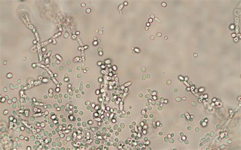 Yeast Culture