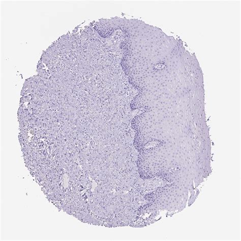 Tissue Expression Of Satb2 Staining In Vagina The Human Protein Atlas