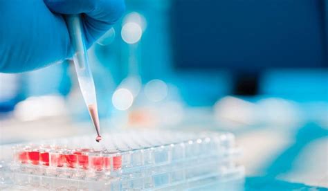 Arthritis Immunodiagnostic Systems Ids