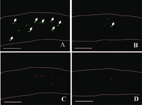 Representative Immunohistochemical Staining For Cd11c Red In The